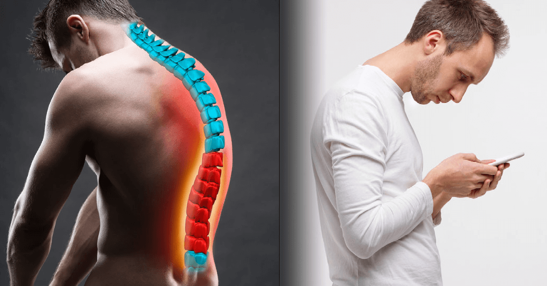 Is Kyphosis Causing Your or Your Child Back Pain? | Jeevam Therapy